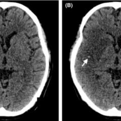 MCA-Punkt-Zeichen - DocCheck Flexikon
