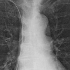Pulsation - DocCheck Flexikon