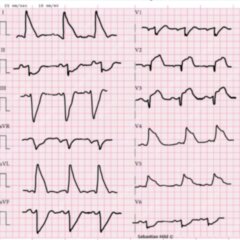 Shark-Fin-Zeichen - DocCheck Flexikon
