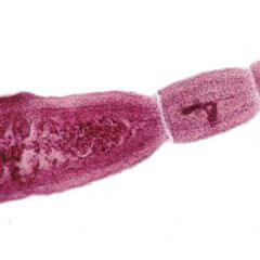 Ciclo De Vida Do Echinococcus Multilocularis