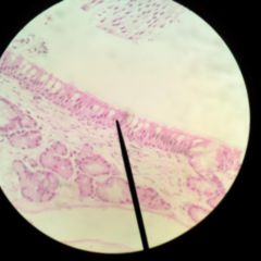 Flimmerepithel - DocCheck Flexikon