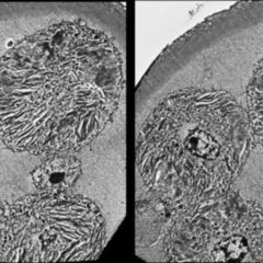 Intermediate metabolizer - DocCheck Flexikon