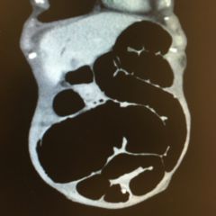 Colon descendens - DocCheck Flexikon