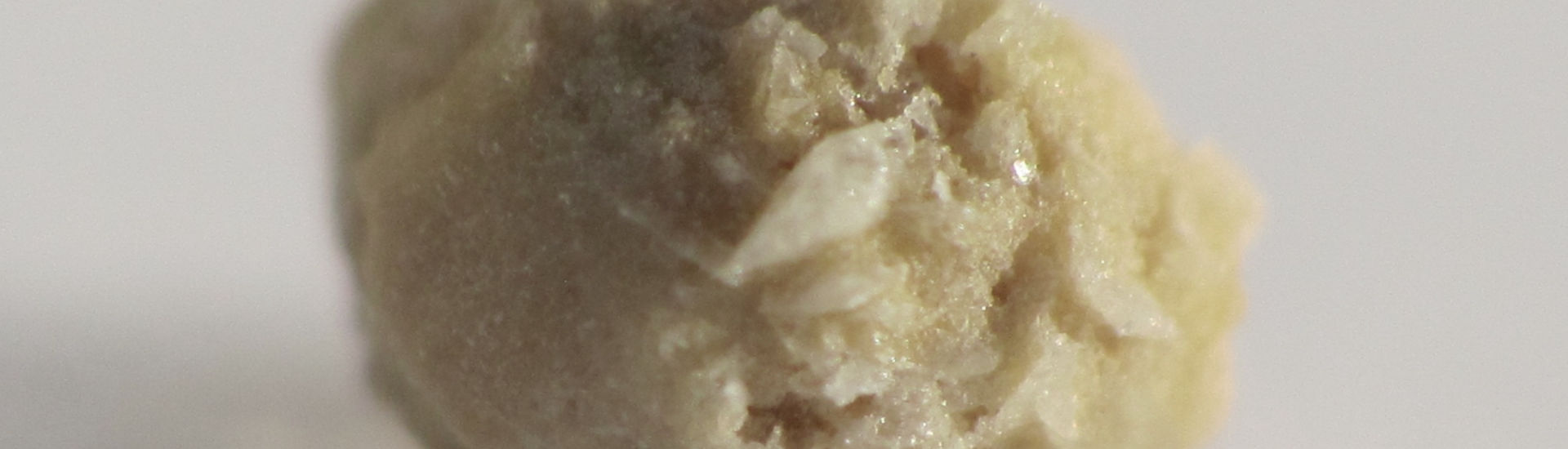 Harnsteine im Schnelldurchlauf - DocCheck