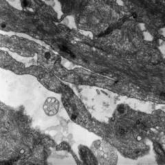 Caveola - DocCheck Flexikon