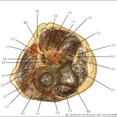Caput mandibulae - DocCheck Flexikon