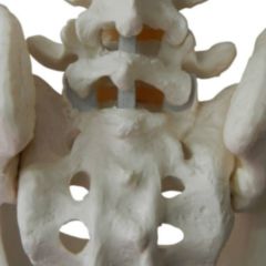 Lumbosakralgelenk - DocCheck Flexikon