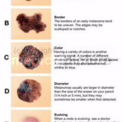 ABCDE-Regel - DocCheck Flexikon