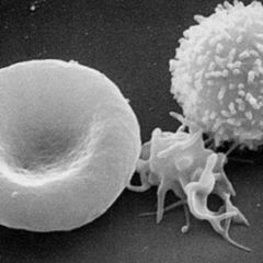 Retikulierter Thrombozyt - DocCheck Flexikon