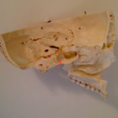 Sinus sphenoidalis - DocCheck Flexikon