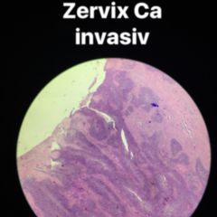 Cervix uteri - DocCheck Flexikon