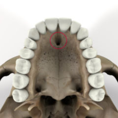 Foramen incisivum - DocCheck Flexikon