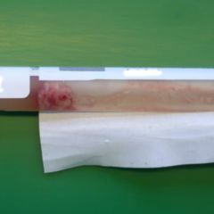 Gewebeprobe - DocCheck Flexikon