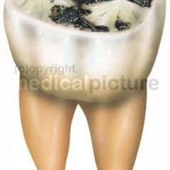 Sharpey-Faser - DocCheck Flexikon