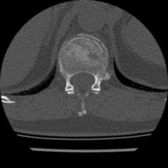 BWK - DocCheck Flexikon