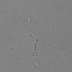 MACE - DocCheck Flexikon