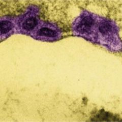 Endosom - DocCheck Flexikon