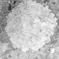Phagolysosom - DocCheck Flexikon