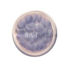 Chorionzotte - DocCheck Flexikon