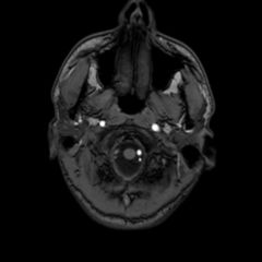 Transversalebene - DocCheck Flexikon