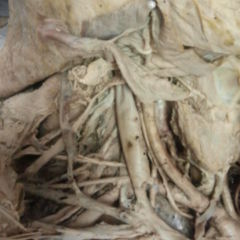 Truncus intestinalis - DocCheck Flexikon