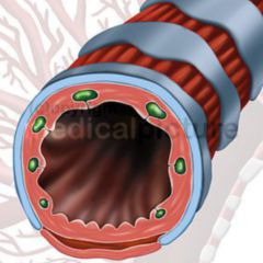 Bronchus - DocCheck Flexikon