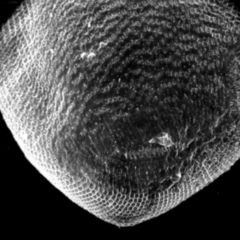 Herniation Pit - DocCheck Flexikon