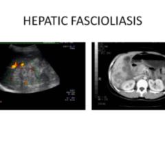 Arteria hepatica propria - DocCheck Flexikon