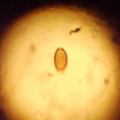 Millimeter Quecksilbersäule - DocCheck Flexikon