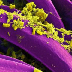 Beulenpest - DocCheck Flexikon