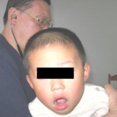 Atemgeräusch - DocCheck Flexikon