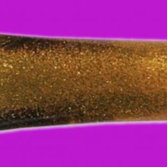 Pustel - DocCheck Flexikon