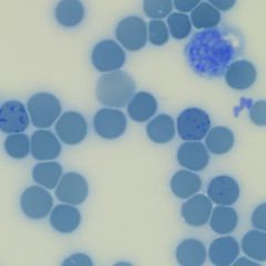 Retikulozyt - DocCheck Flexikon