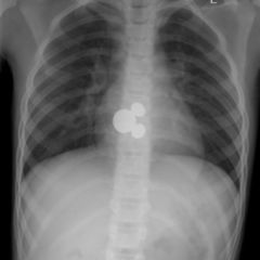 Mickey-Mouse-Zeichen - DocCheck Flexikon