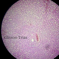 Glisson-Trias - DocCheck Flexikon