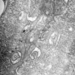 Zellfusion - DocCheck Flexikon