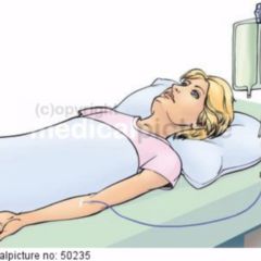 Subkutane Infusion - DocCheck Flexikon