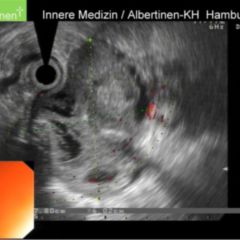 Nekrose - DocCheck Flexikon