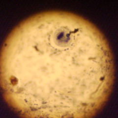 Paradoxe Diarrhö - DocCheck Flexikon