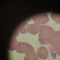 Borrelia - DocCheck Flexikon