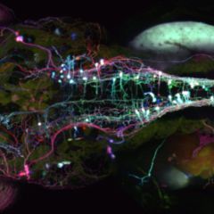 Nervenzelle - DocCheck Flexikon