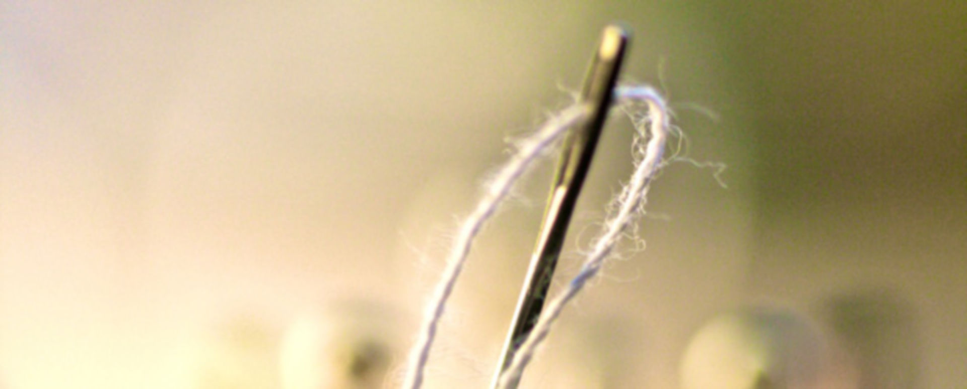 Zervixcerclage: Geschickt eingefädelt - DocCheck