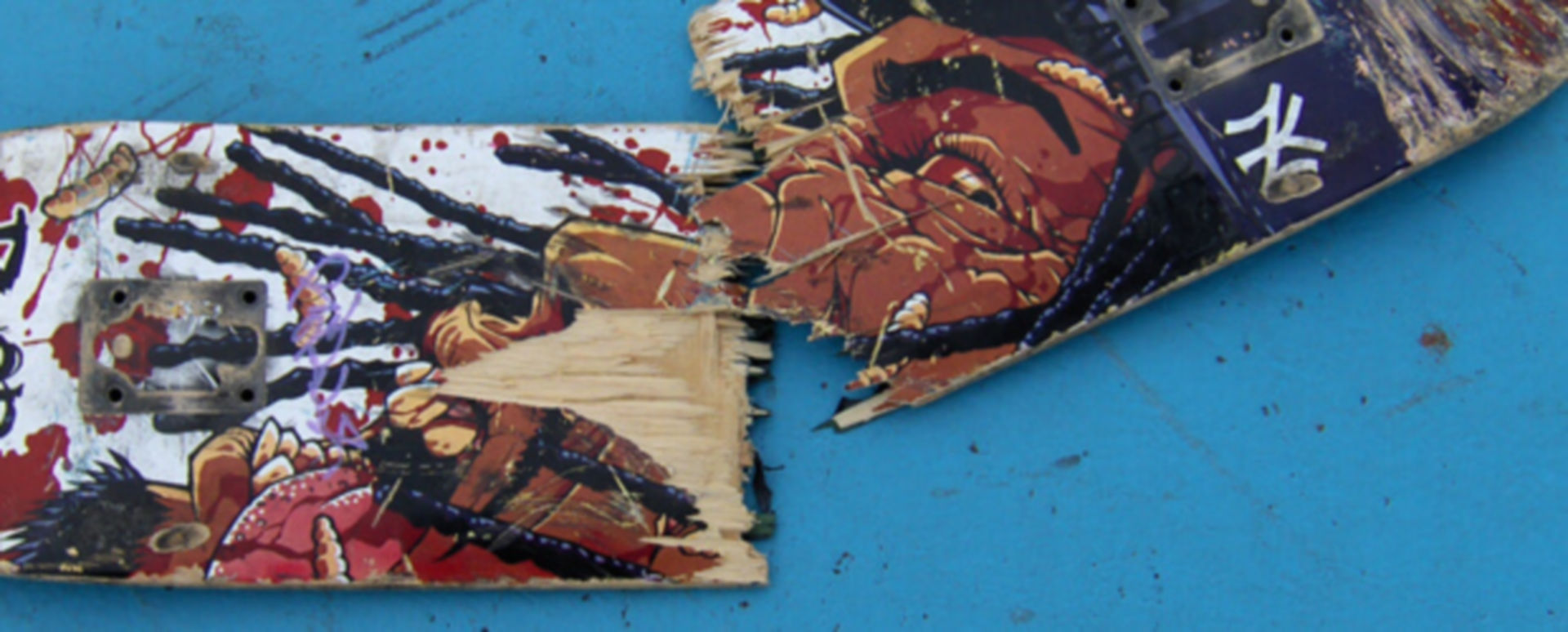 Lomitapid: Zusatznutzen bei Hypercholesterinämie? - DocCheck