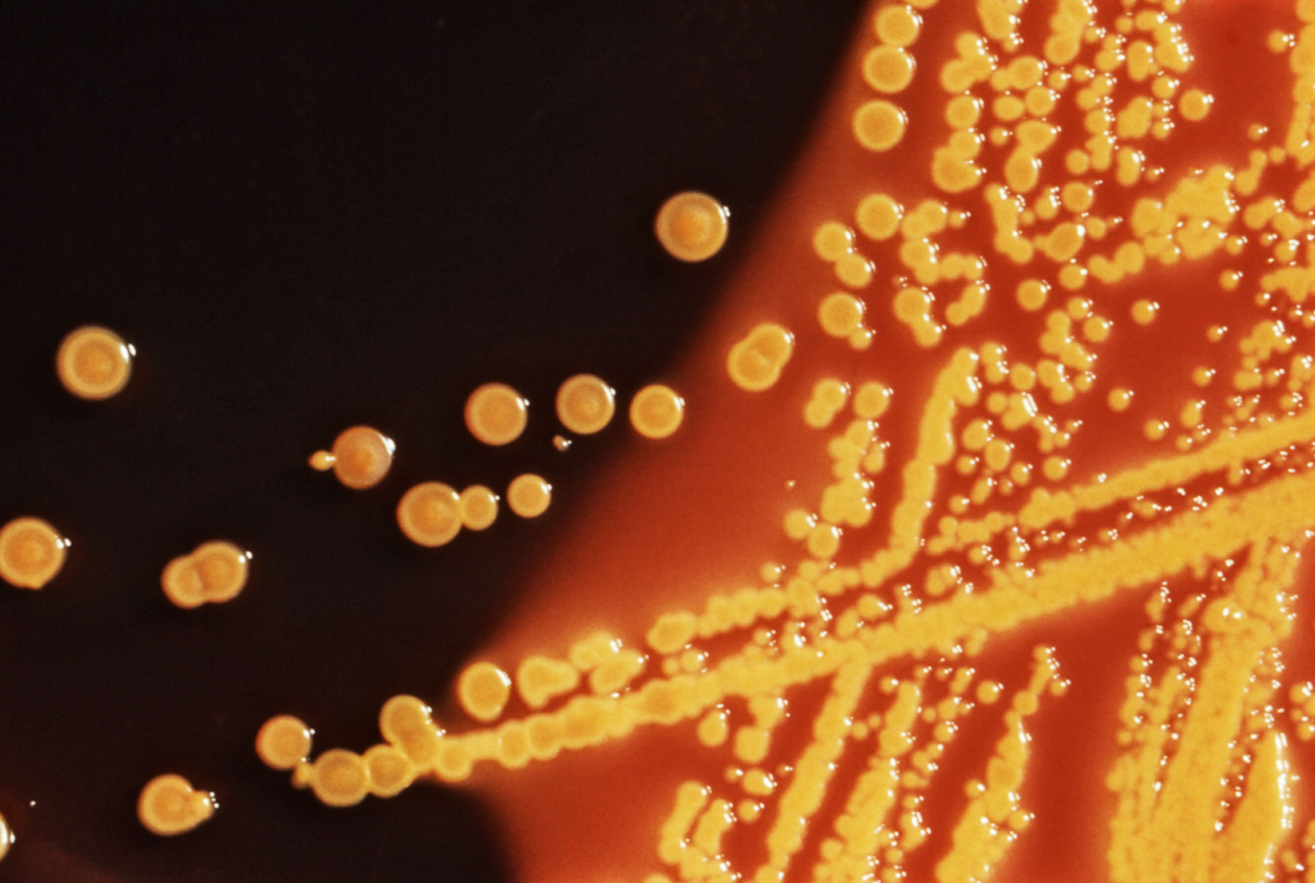 Escherichia Coli HE Agar DocCheck Escherichia Coli HE Agar DocCheck