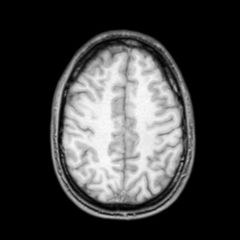 Gyrus postcentralis - DocCheck Flexikon