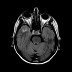 Bulbus - DocCheck Flexikon