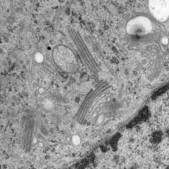 Cisterna basalis - DocCheck Flexikon