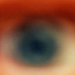 Augenwinkel - DocCheck Flexikon