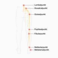 Ischialgie - DocCheck Flexikon