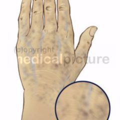 Haut - DocCheck Flexikon